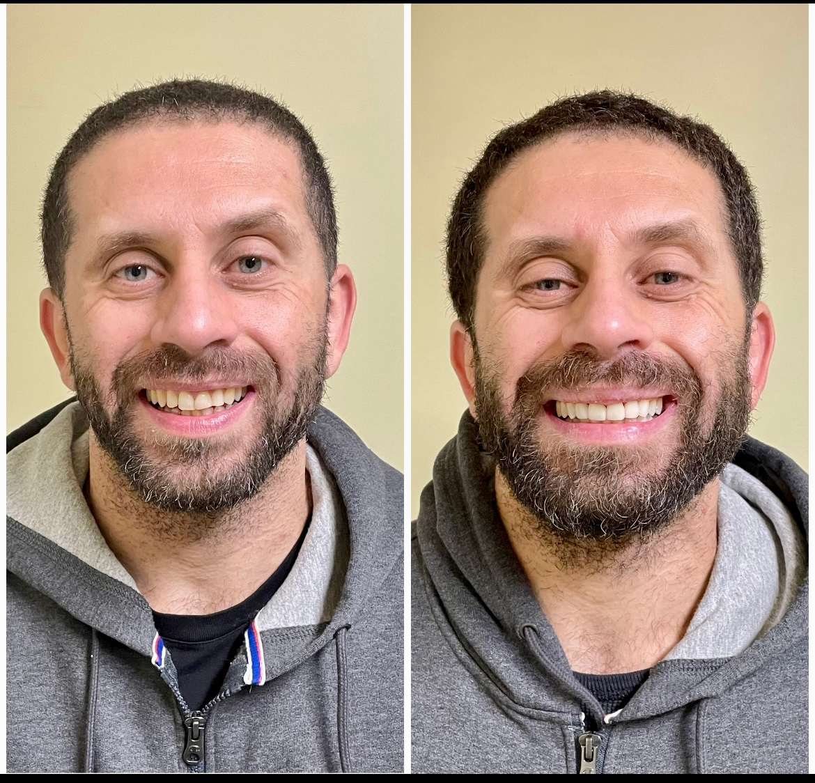 Smile Gallery | Smile in Style Dentistry | Bellerose, NY